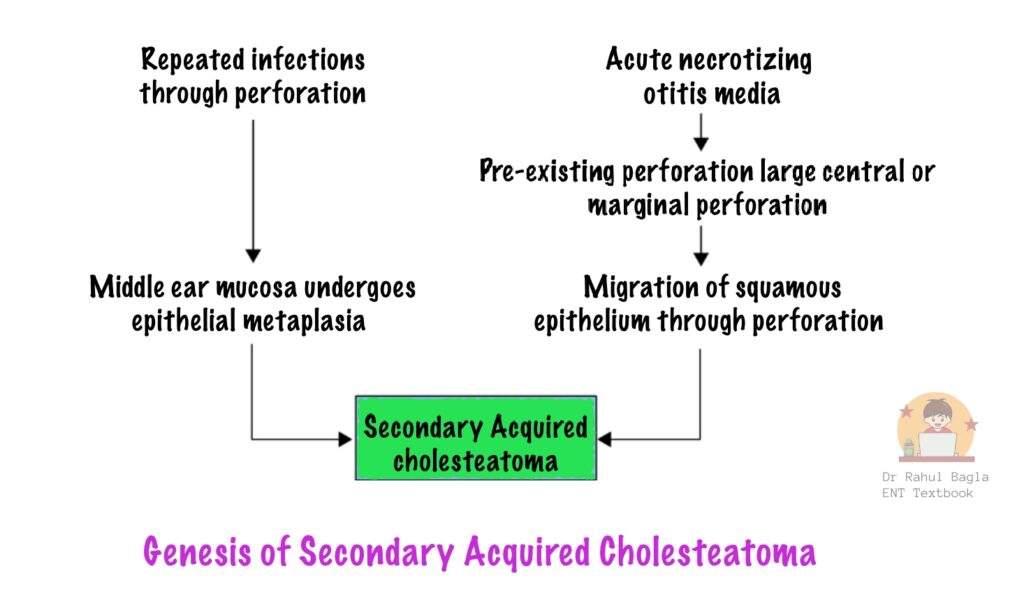 Cholesteatoma - Wittmaack, Ruedi, Habermann, Sade, Theories