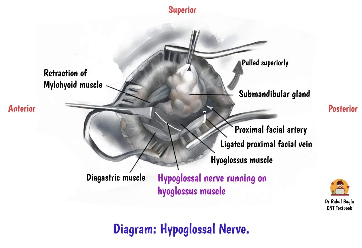 Submandibular Gland Surgery - How to protect Marginal Mandibular Nerve