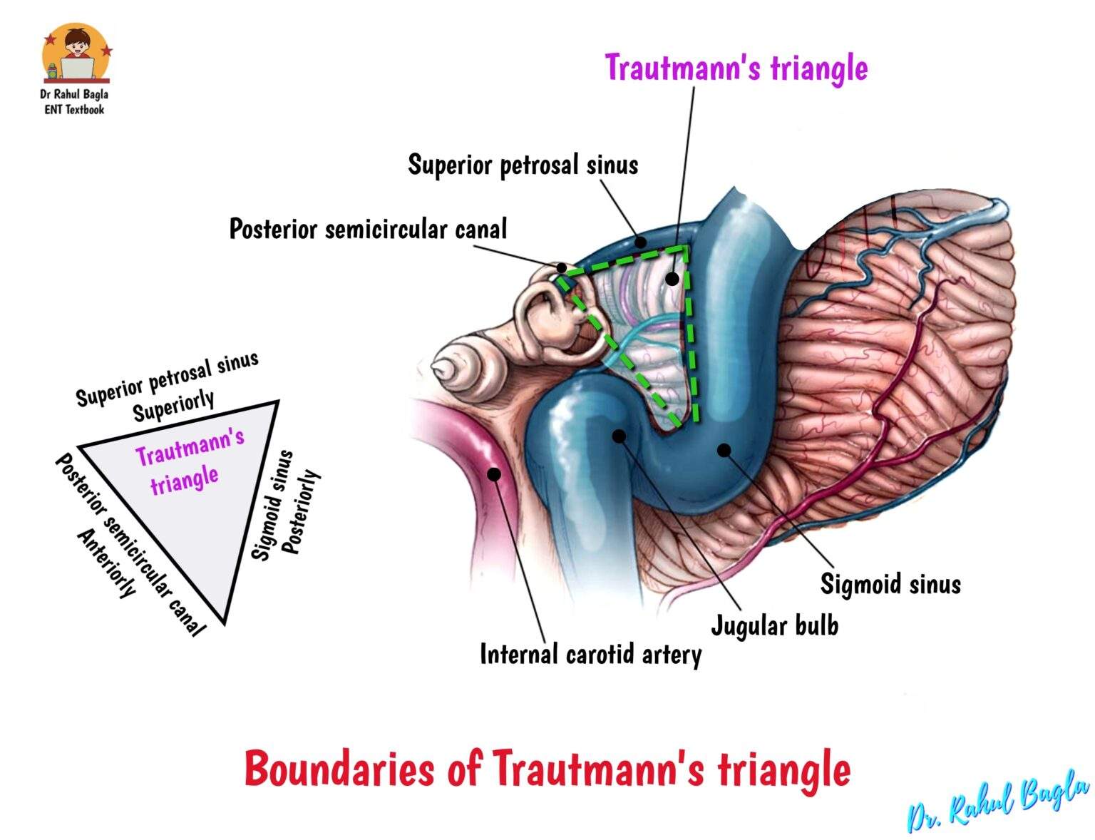 Complications of CSOM - From Hearing Loss to Life-Threatening Risks