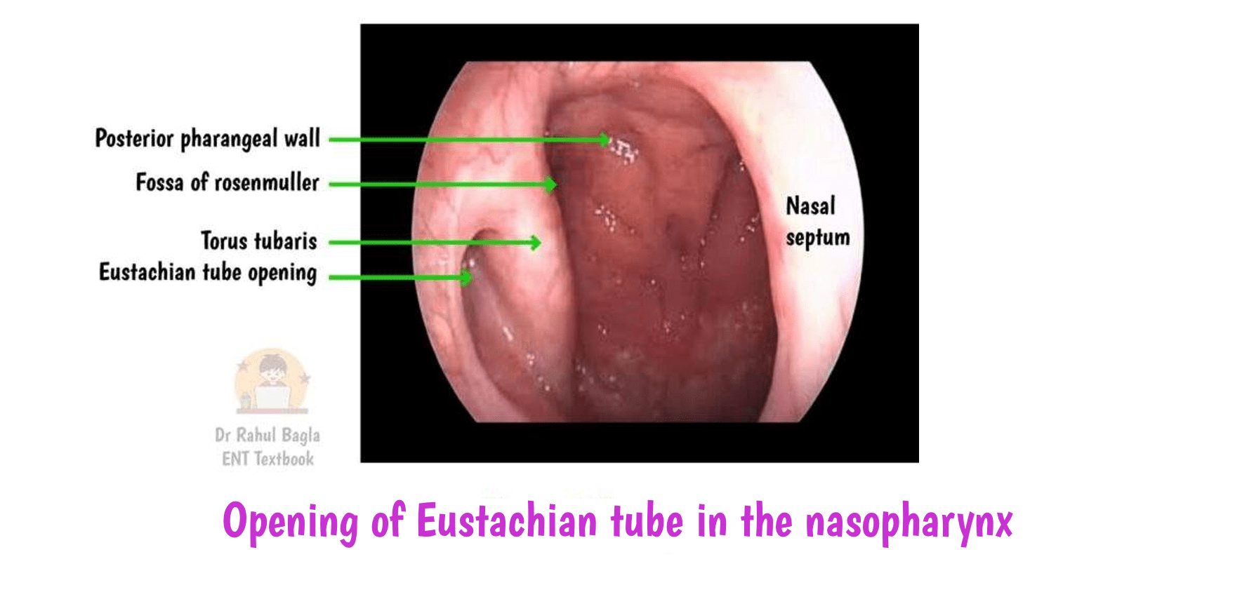 Eustachian Tube Anatomy - Understanding the Anatomy of the Eustachian Tube