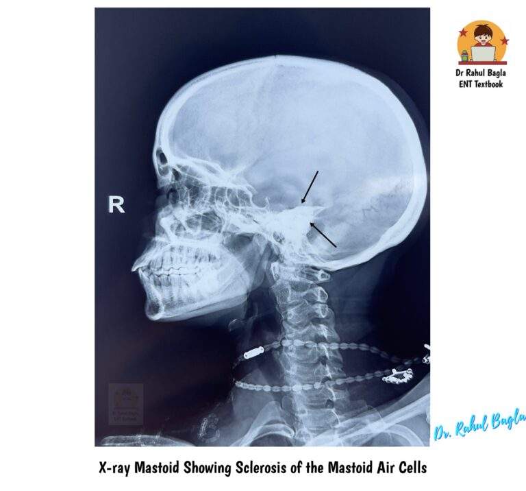Anatomy of Middle ear - Dr. Rahul Bagla ENT Textbook