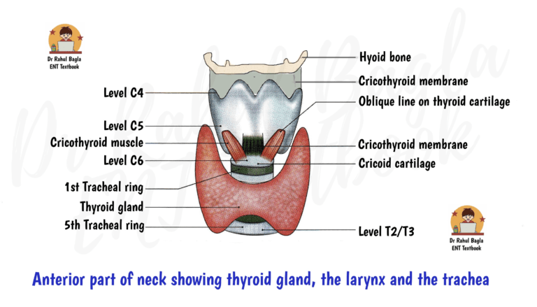 Tracheostomy in Infants and Children - A Comprehensive Guide
